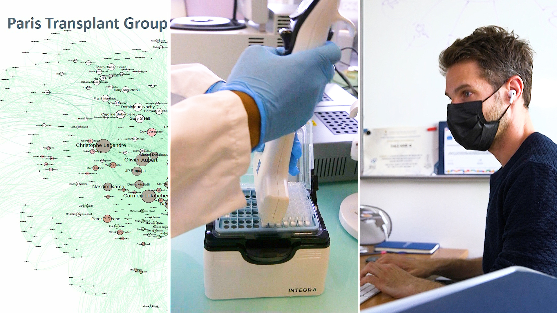 iBox : mieux prédire le rejet de greffe | Université Paris Cité