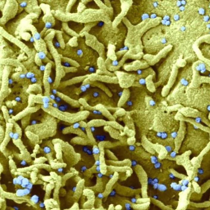 cellule-infectée-SARS-Inserm | Université Paris Cité