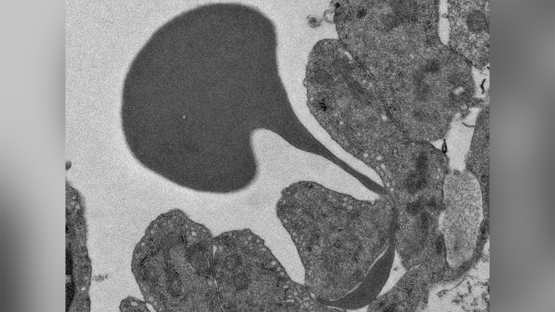 Paludisme : rigidifier les globules rouges infectés pour stopper la ...